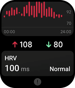 Powered by LVGL: Redefining IDO‘s Smartwatch User Interfaces — Case ...
